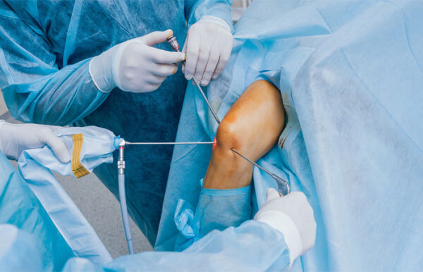 Knee Arthroscopy Surgery in Ghaziabad | Dr. Abhinav Singhal