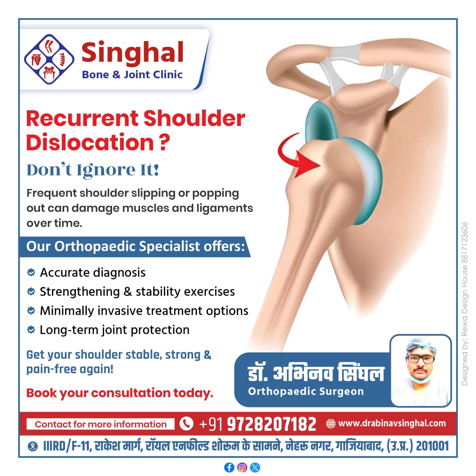 Recurrent Shoulder Dislocation: Why You Shouldn’t Ignore the Warning ...
